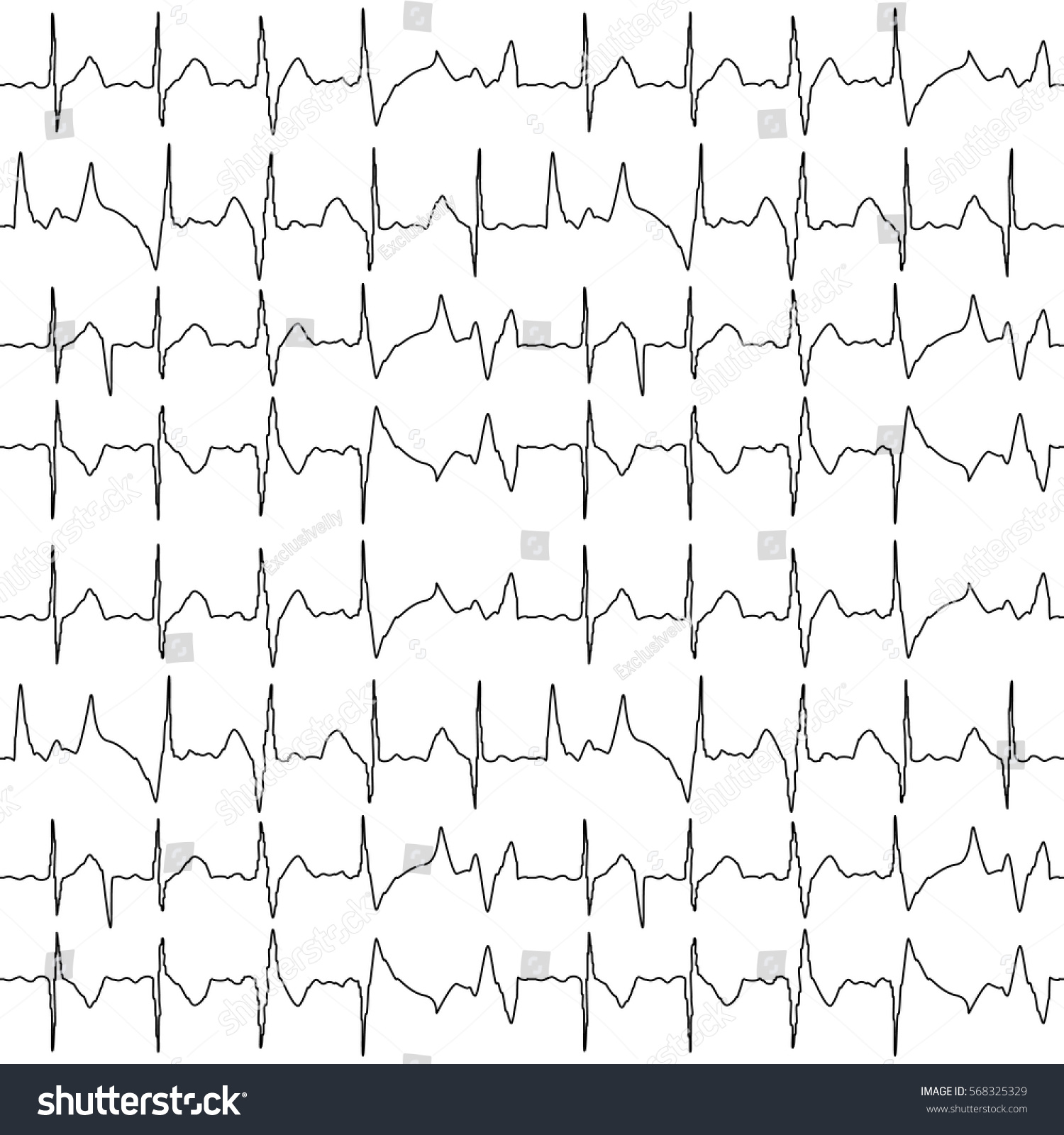 Seamless Pattern Ekg Cardiograms Chart Stock Vector Royalty Free