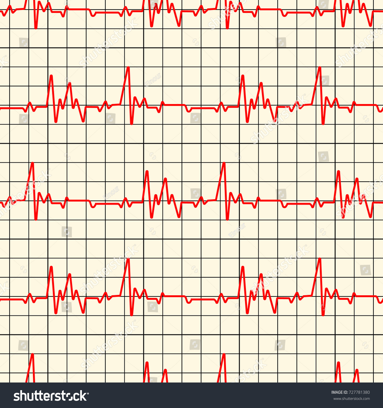 Seamless Pattern Ekg Cardiograms Chart Seamless Stock Vector Royalty