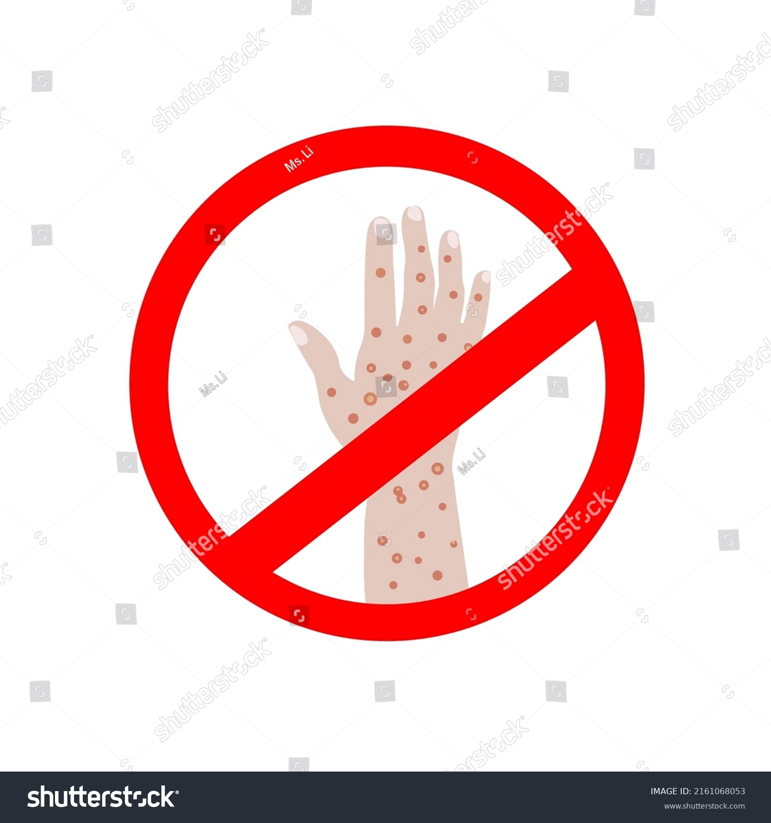 Sign Stop Monkeypox Vector Eps 10 Stock Vector (Royalty Free ...