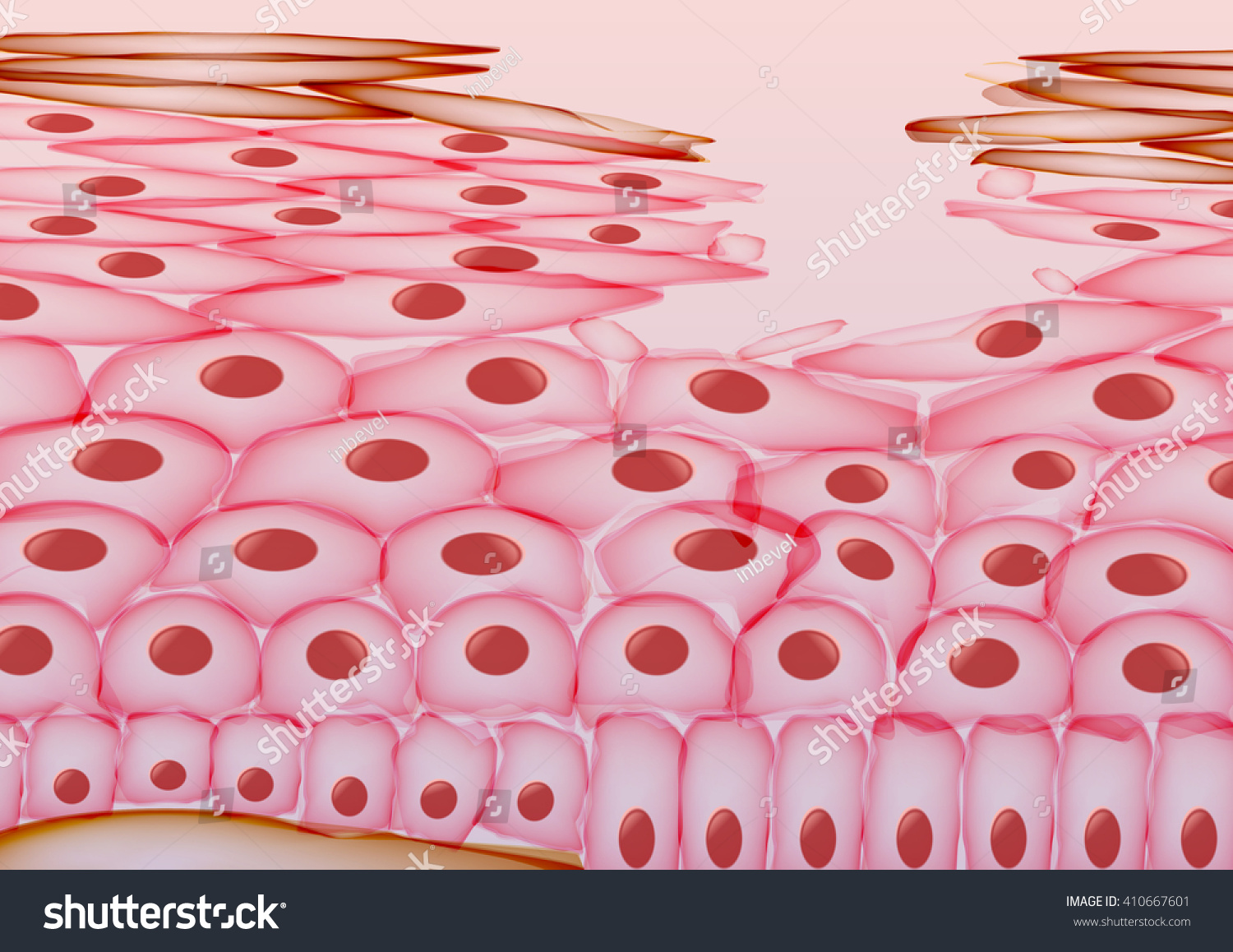 Skin Cell Damage Layers Vector Illustration Stock Vector (Royalty Free ...