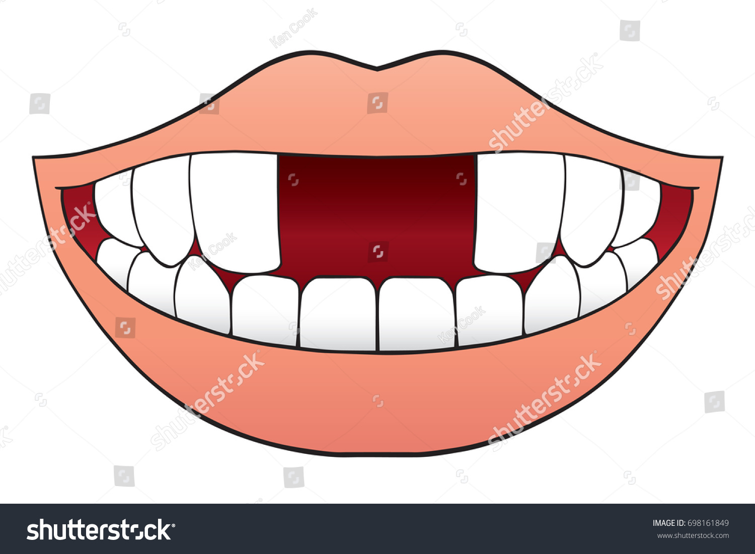 Smiling Cartoon Mouth Two Front Teeth Stock Vector 698161849 - Shutterstock