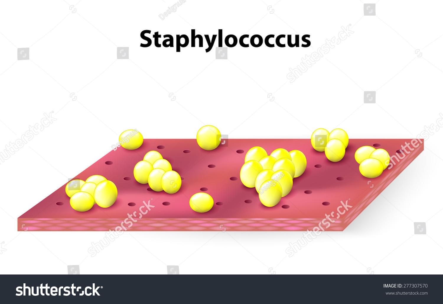 Staphylococcus Colonies On Skin Surface Vector Stock Vector (Royalty ...