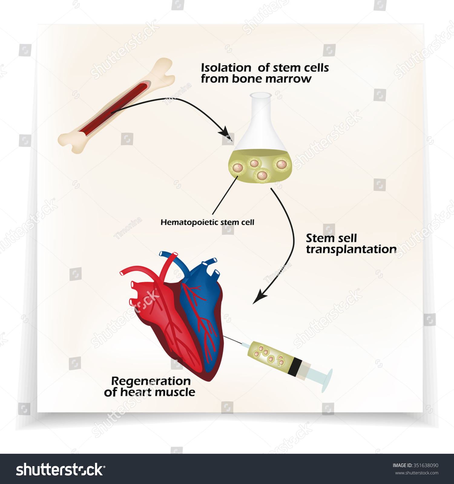 Stem Cells Bone Marrow Used Regenerate Stock Vector Royalty Free 351638090