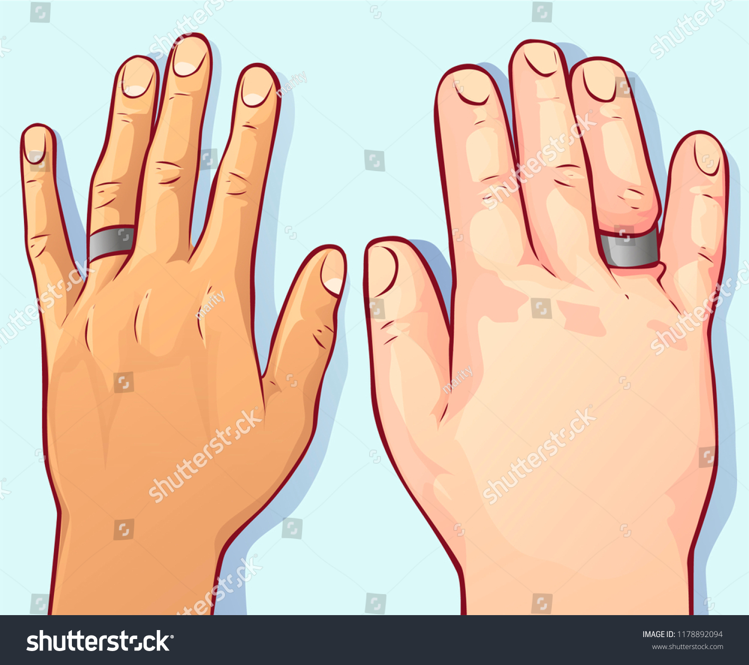 856 Swollen hands Stock Vectors, Images & Vector Art | Shutterstock