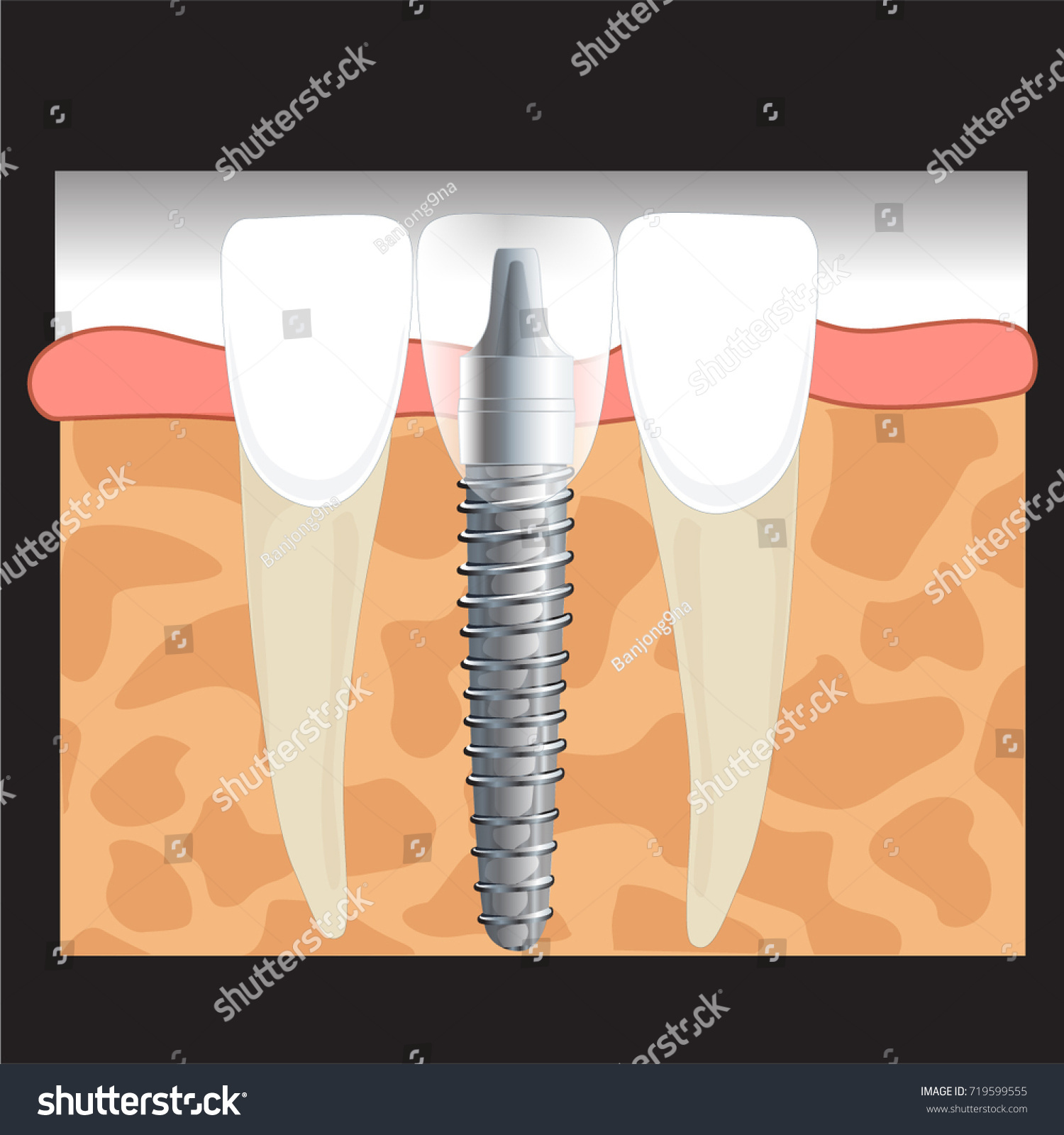 Teeth Dentistrootdental Vector 10 Stock Vector (Royalty Free) 719599555 ...