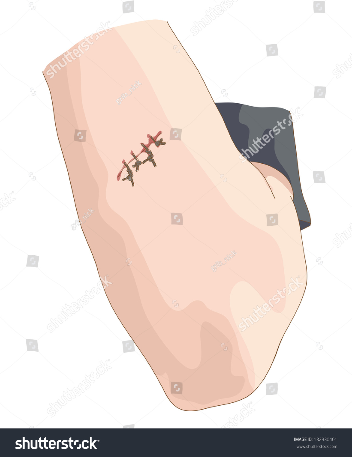 Scar Vector Illustration 库存矢量图（免版税）132930401 | Shutterstock