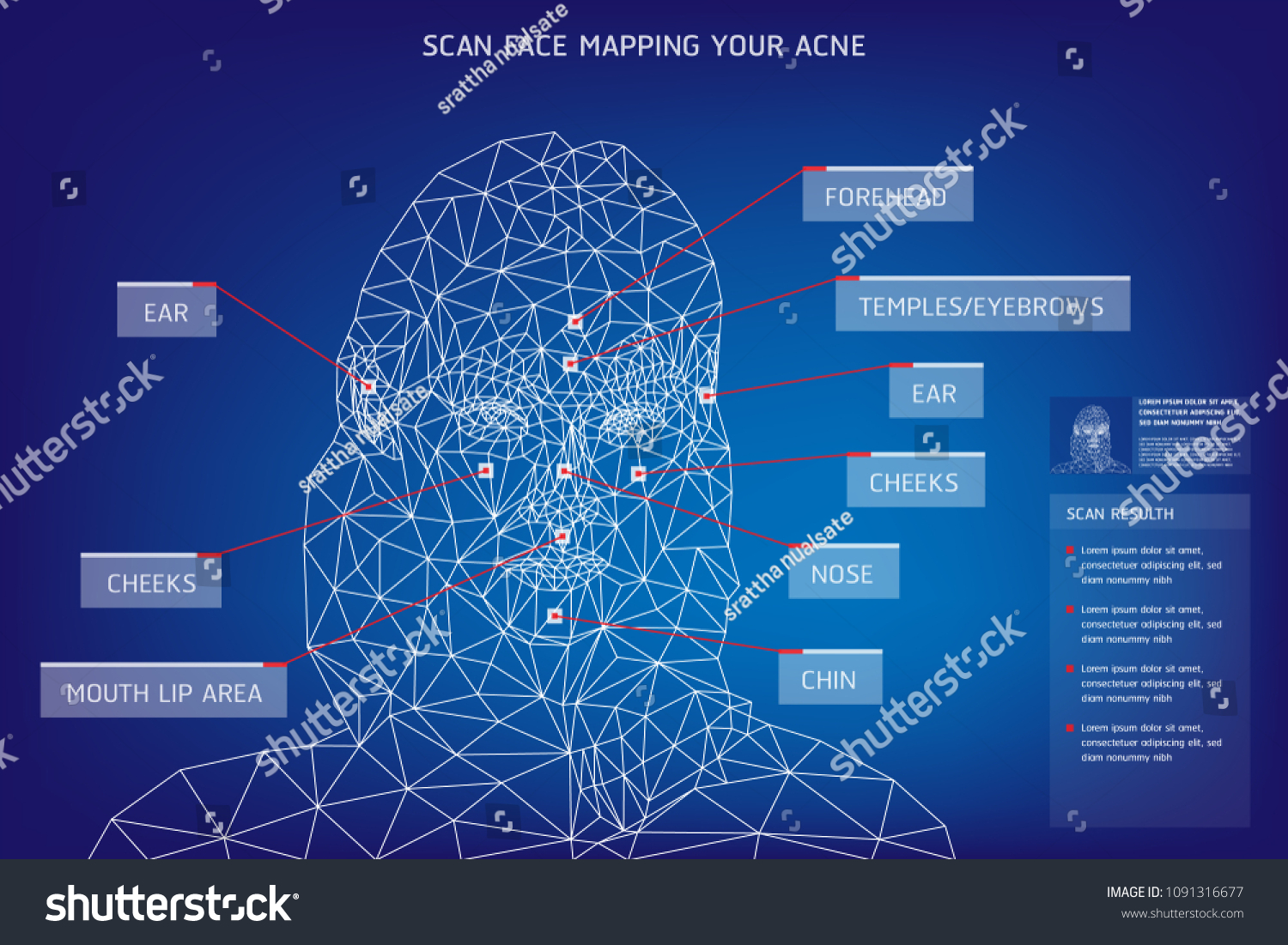 Template Scan Face Mapping Your Acne Stock Vector (Royalty Free ...