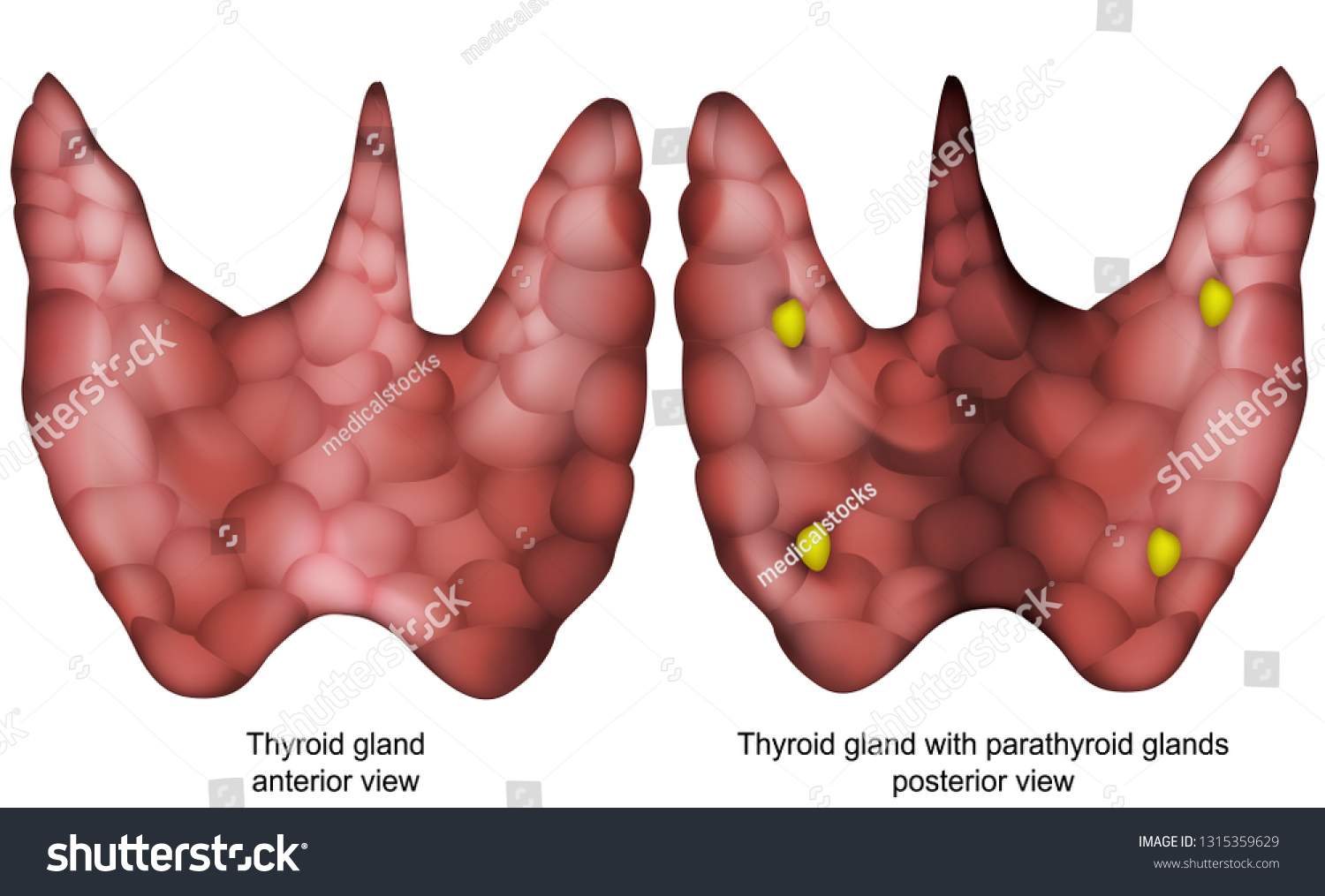 Thyroid Gland 3d Vector Illustration Isolated Stock Vector (Royalty ...