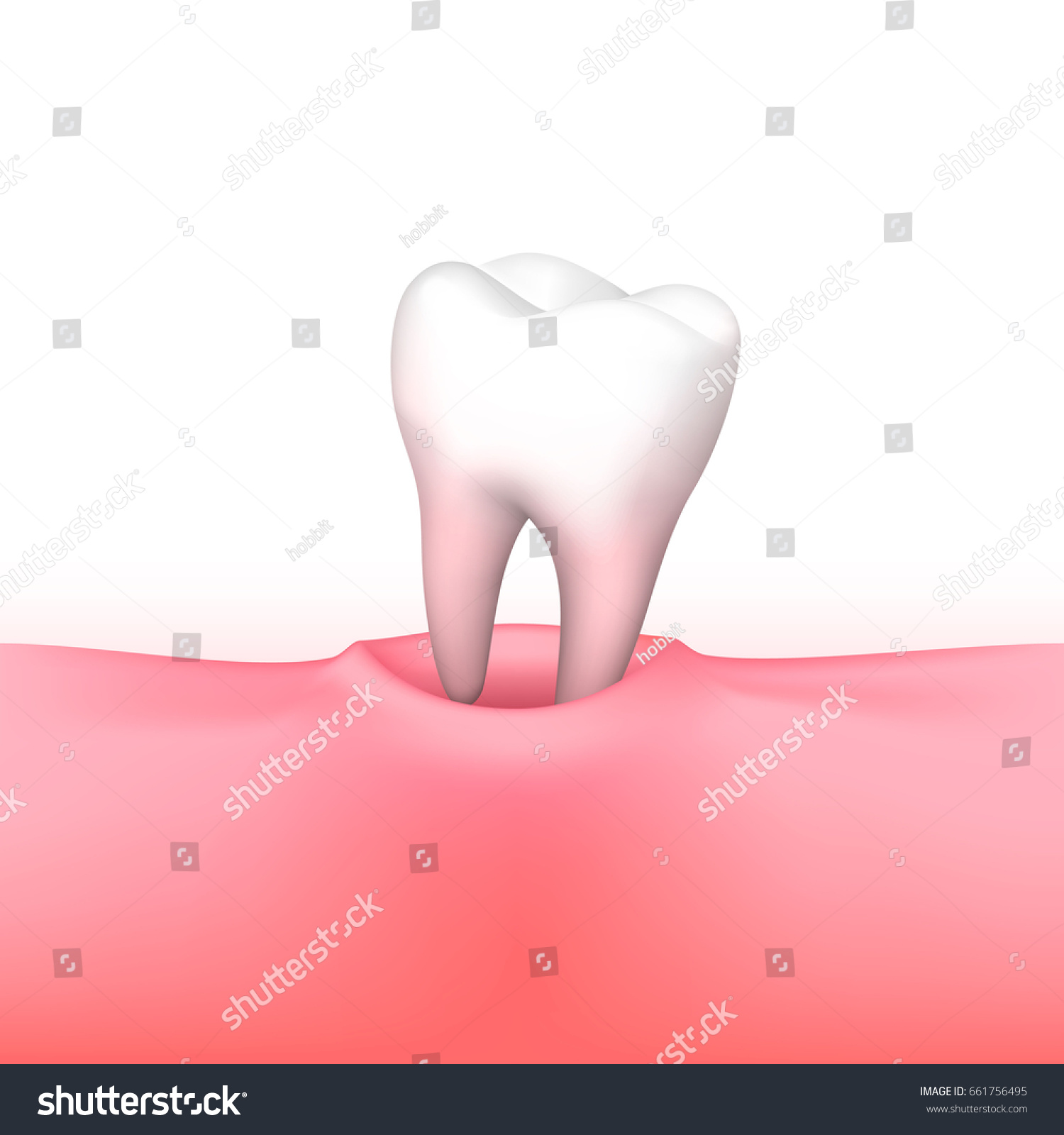 Tooth Loss On White Background Vector Stock Vector (Royalty Free ...