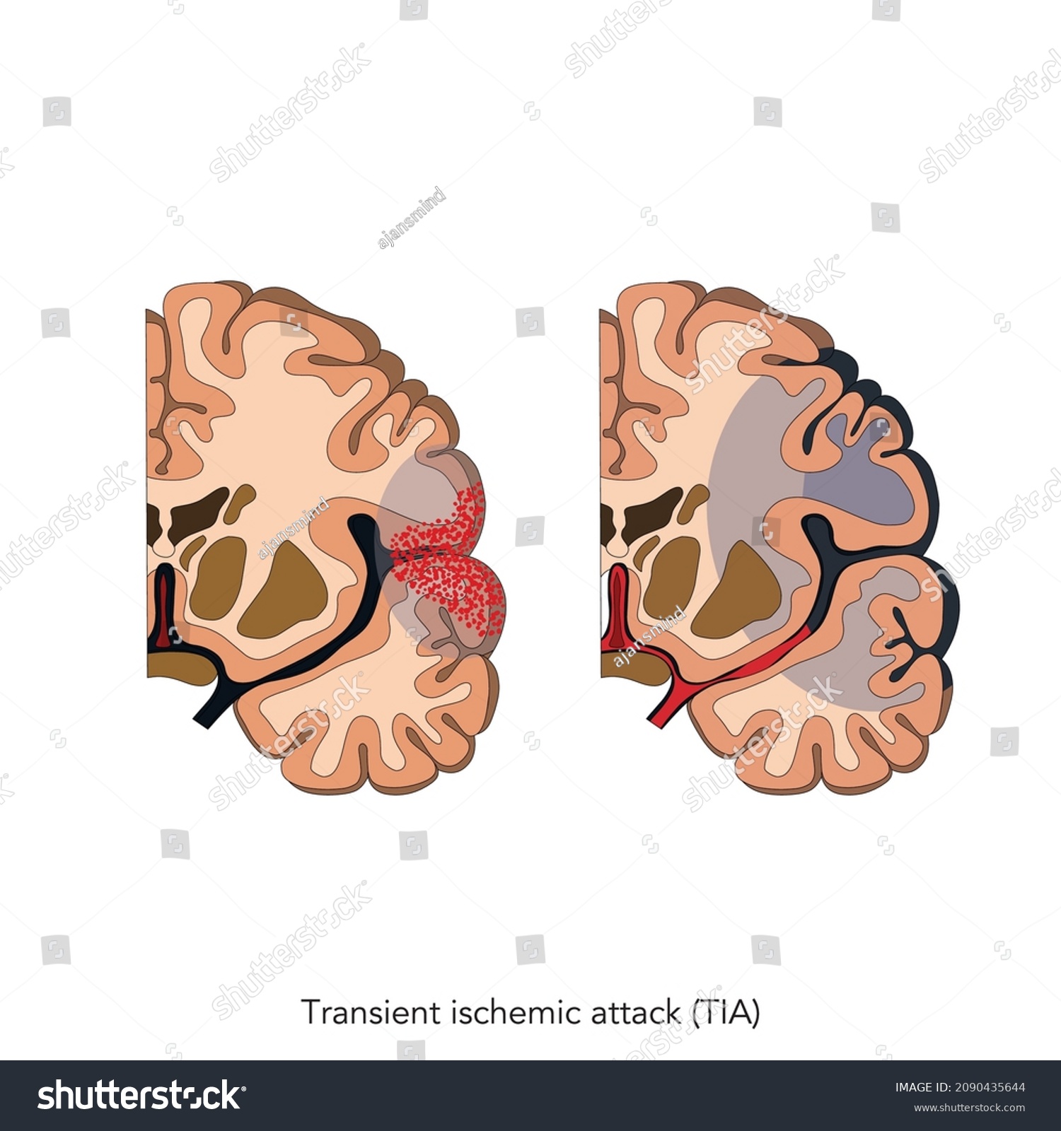 Transient: imágenes, fotos de stock y vectores | Shutterstock
