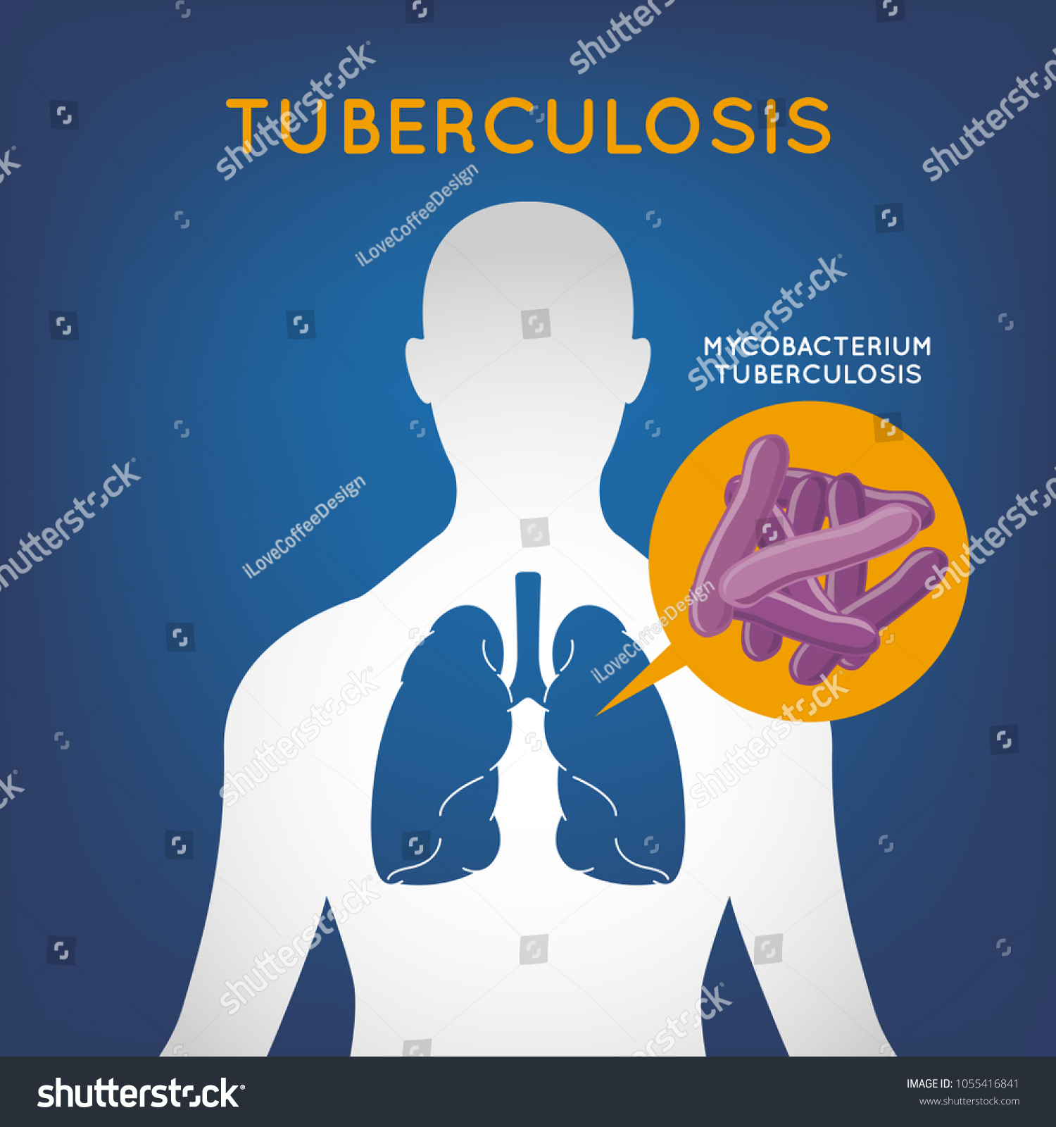 Tuberculosis Vector Logo Icon Illustration: เวกเตอร์สต็อก (ปลอดค่า ...