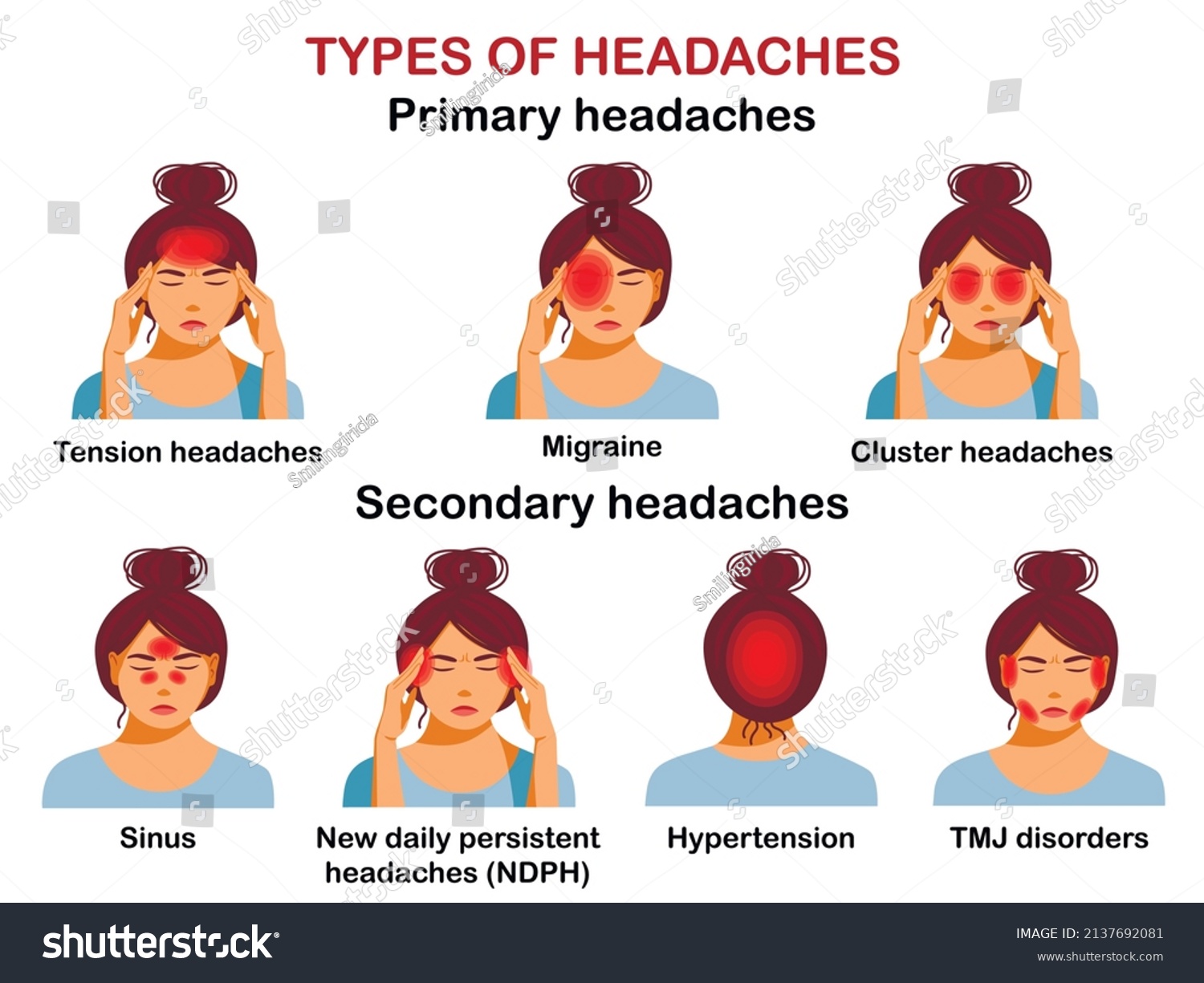 Types Headaches Vector Infographic Stock Vector (Royalty Free ... Types Headaches Vector Infographic Stock Vector (Royalty Free ...