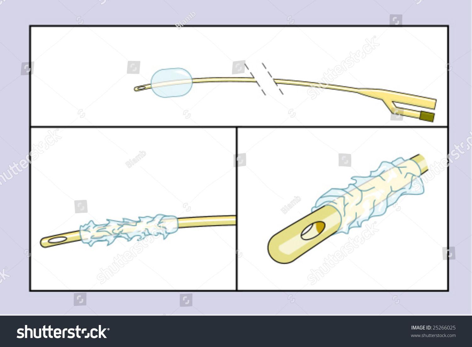 Urinary Foley Catheter Stock Vector 25266025 - Shutterstock