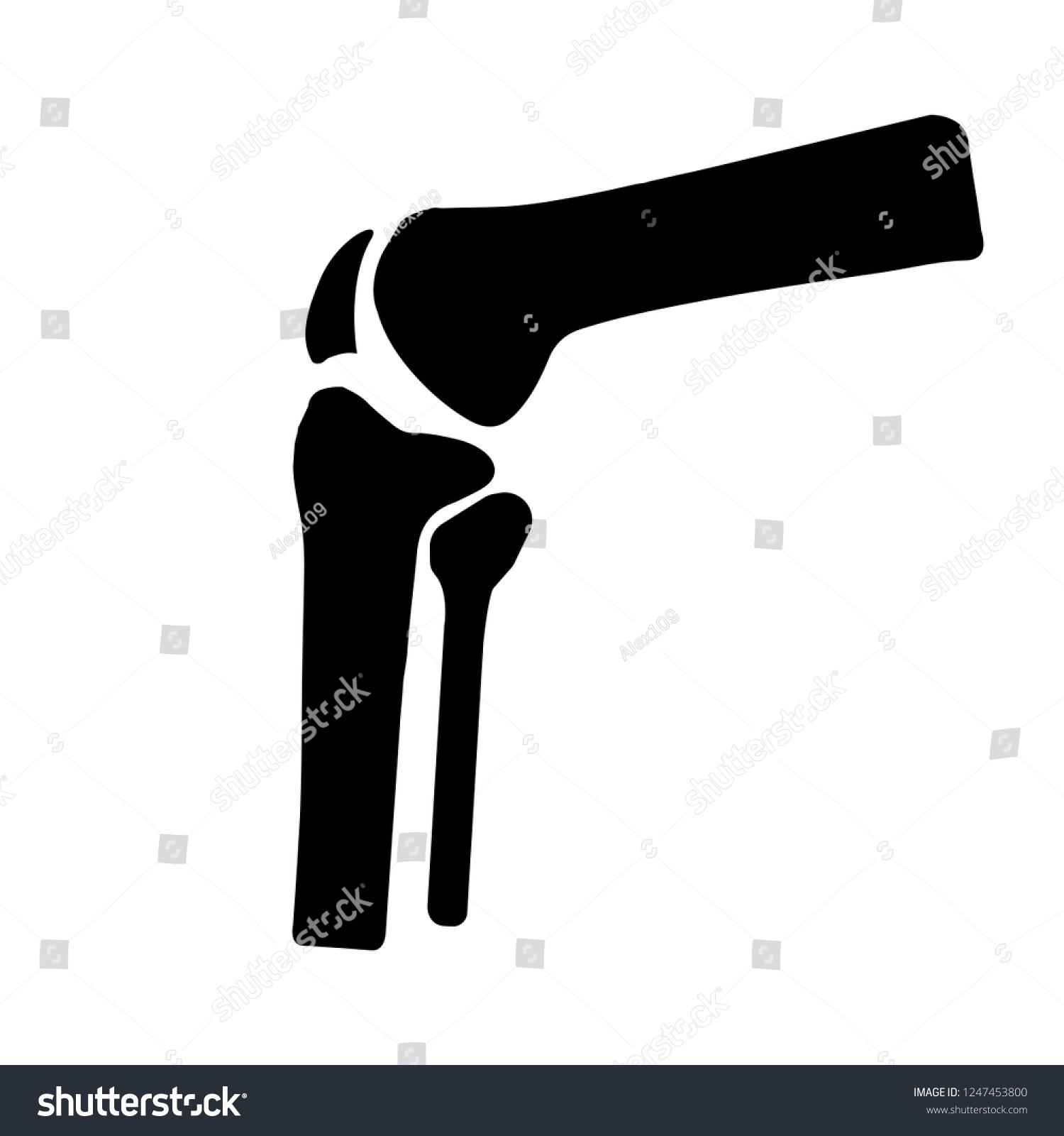 Vector Human Knee Joint Side View: vector de stock (libre de regalías ...