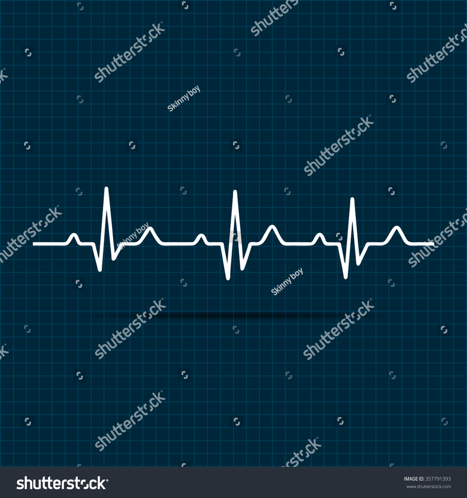 Vector Illustration Heart Rhythm Ekg Vector: เวกเตอร์สต็อก (ปลอดค่า ...