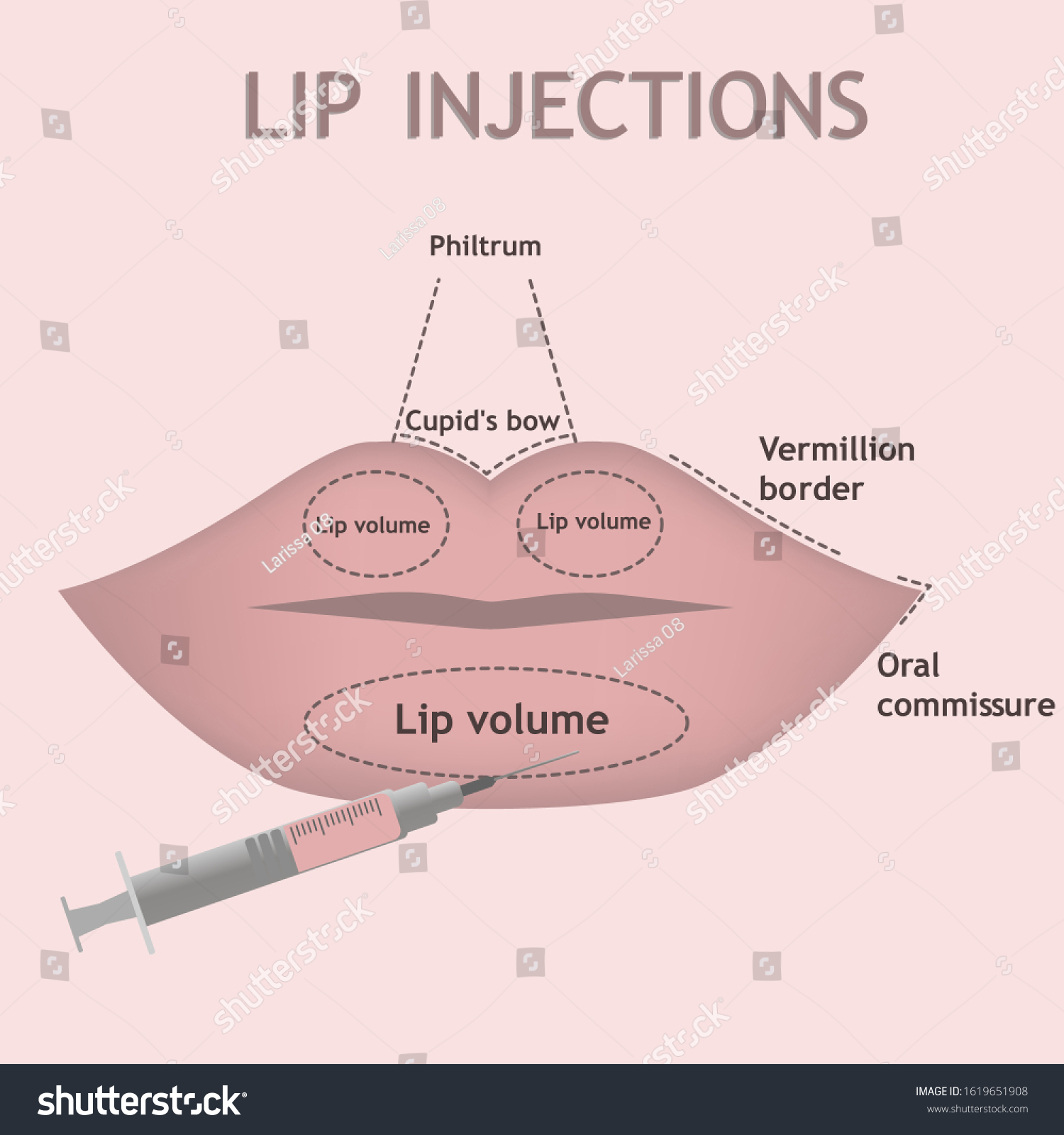 3418 Lip Anatomy Medical Immagini Foto Stock E Grafica Vettoriale Shutterstock