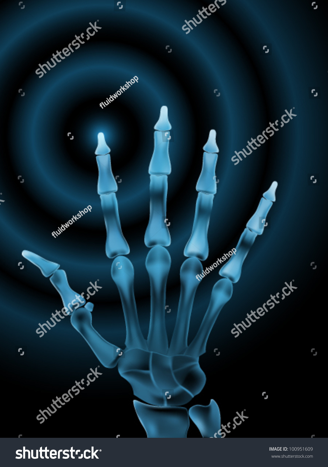 Vector Xray Hand Circle Illustration Stock Vector (Royalty Free) 100951609