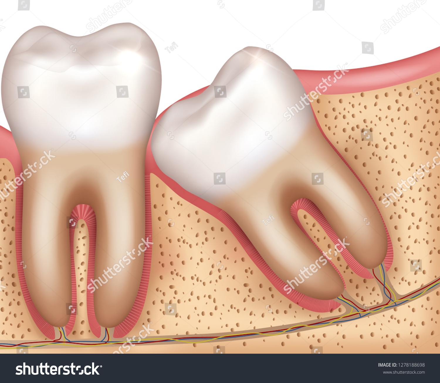 Wisdom Tooth Eruption Problems Illustrated Anatomy Stock Vector ...