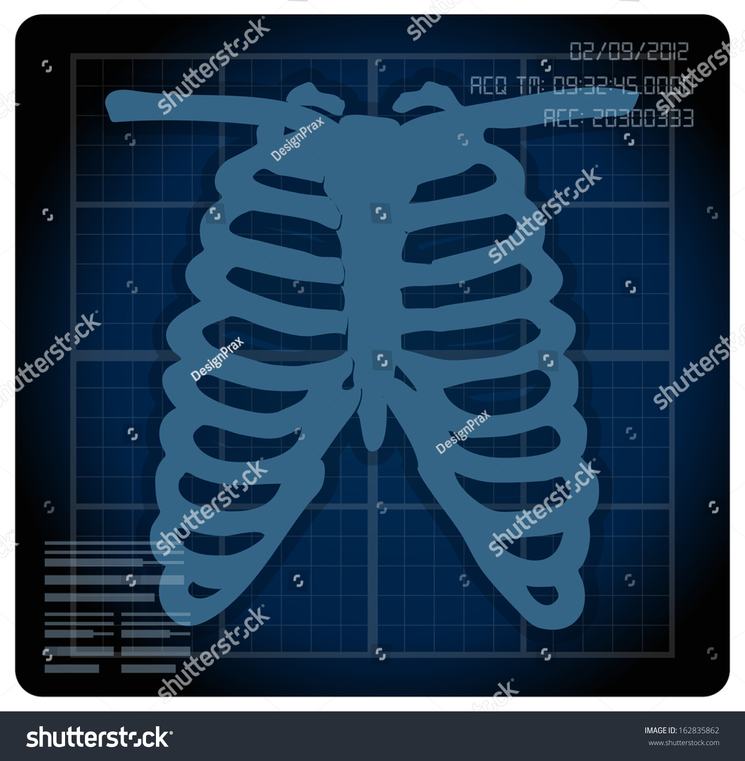 X Ray Illustration Stock Vector (Royalty Free) 162835862 | Shutterstock
