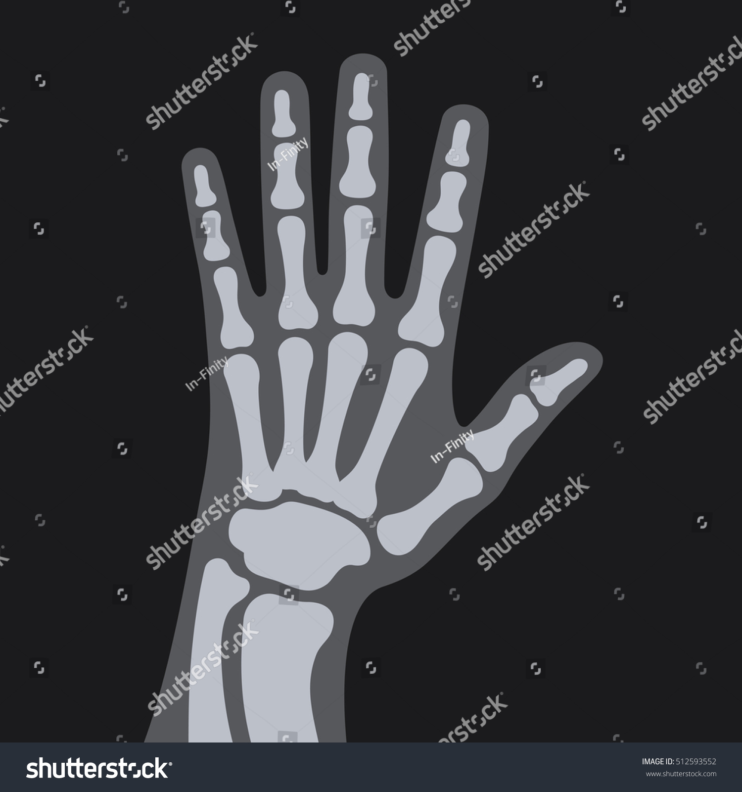 6,647 X ray hand 3d Images, Stock Photos & Vectors | Shutterstock